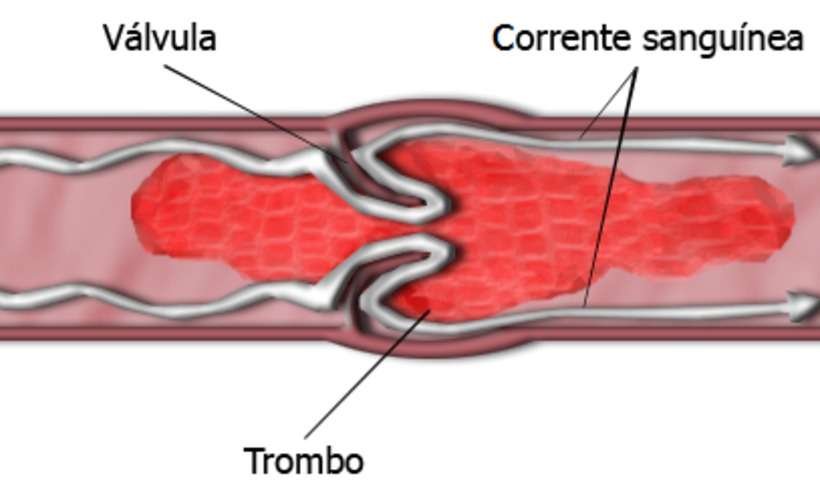 Ischemia: um novo paradigma no tratamento da isquemia coronária - Uai Saúde